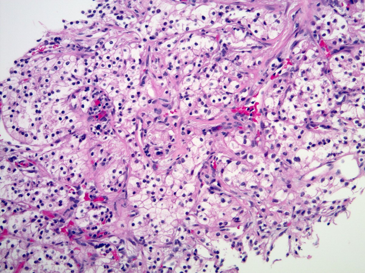 Jerad Gardner, MD on Twitter: Jerad Gardner, MD on Twitter: