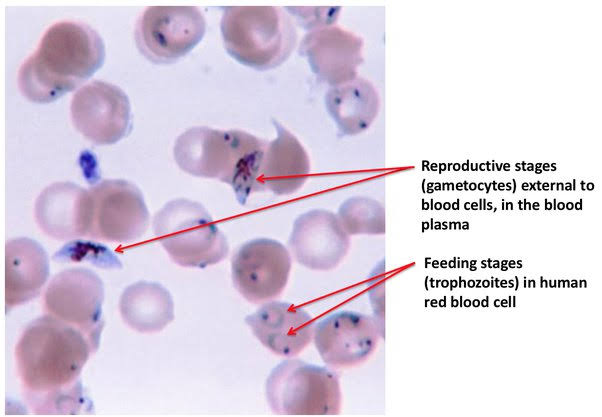 Malaria Vs Platelets