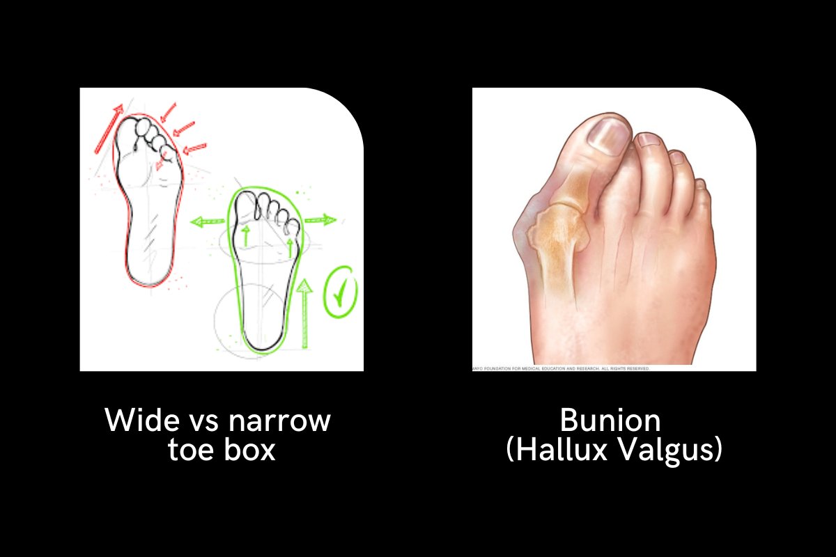 I’ve spent $10,000+ on shoes & 750+ hours studying foot anatomy. My ...