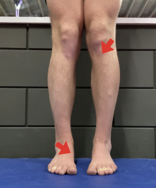 1 in 4 Americans has flat feet. How to strengthening your arch and ...