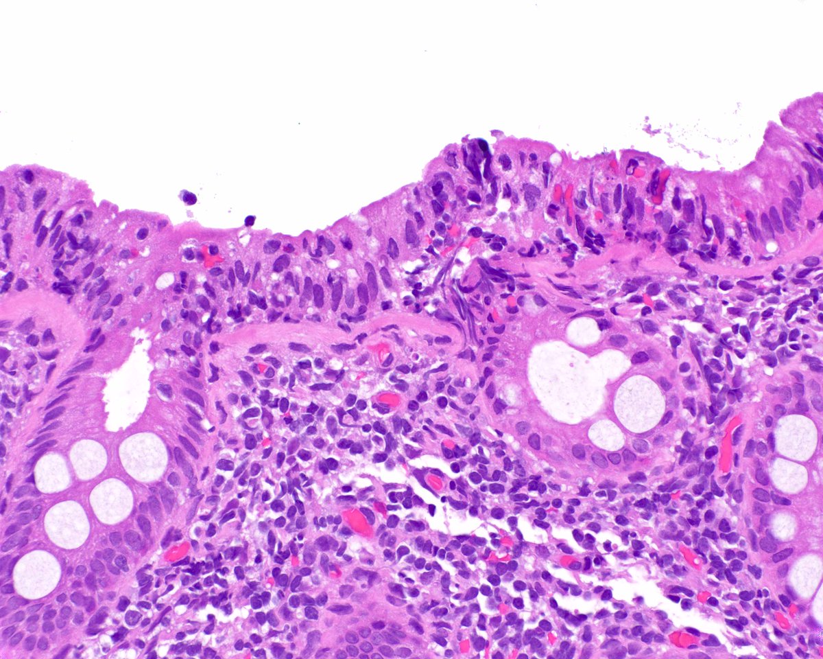 Jerad Gardner, MD on Twitter: Jerad Gardner, MD on Twitter: