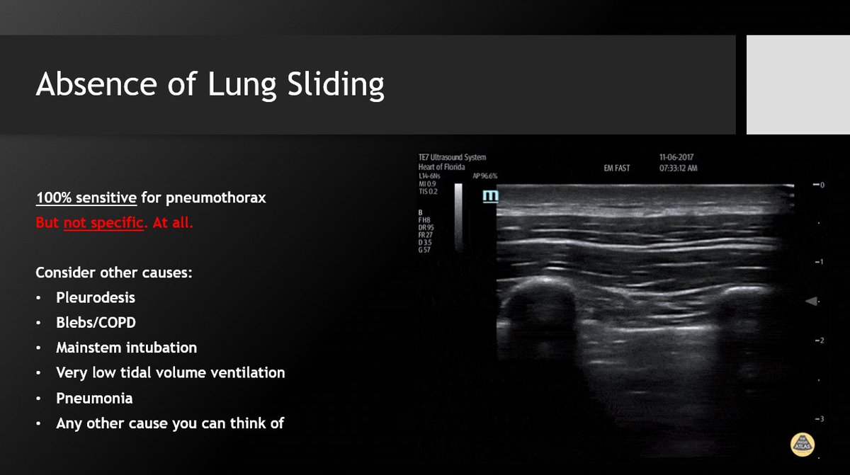 Thoracic Ultrasonography! ...And the long-awaited answers to the ...