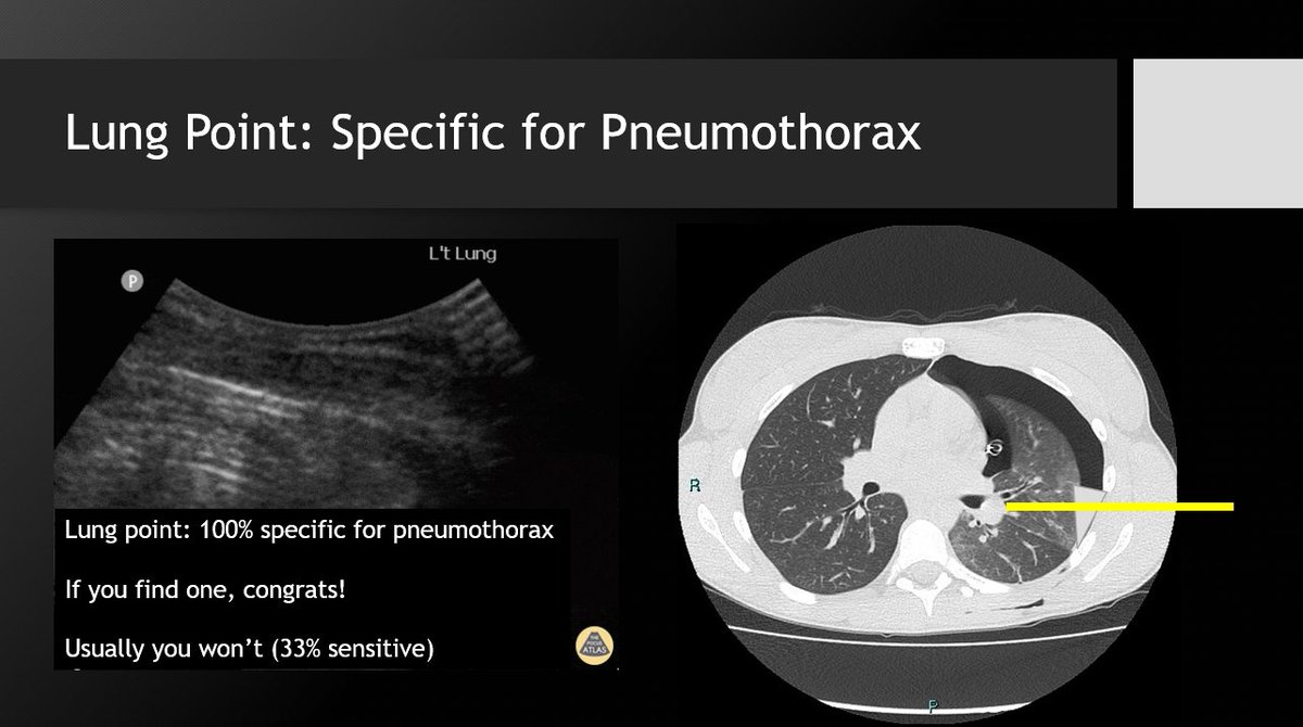 Thoracic Ultrasonography! ...And the long-awaited answers to the ...