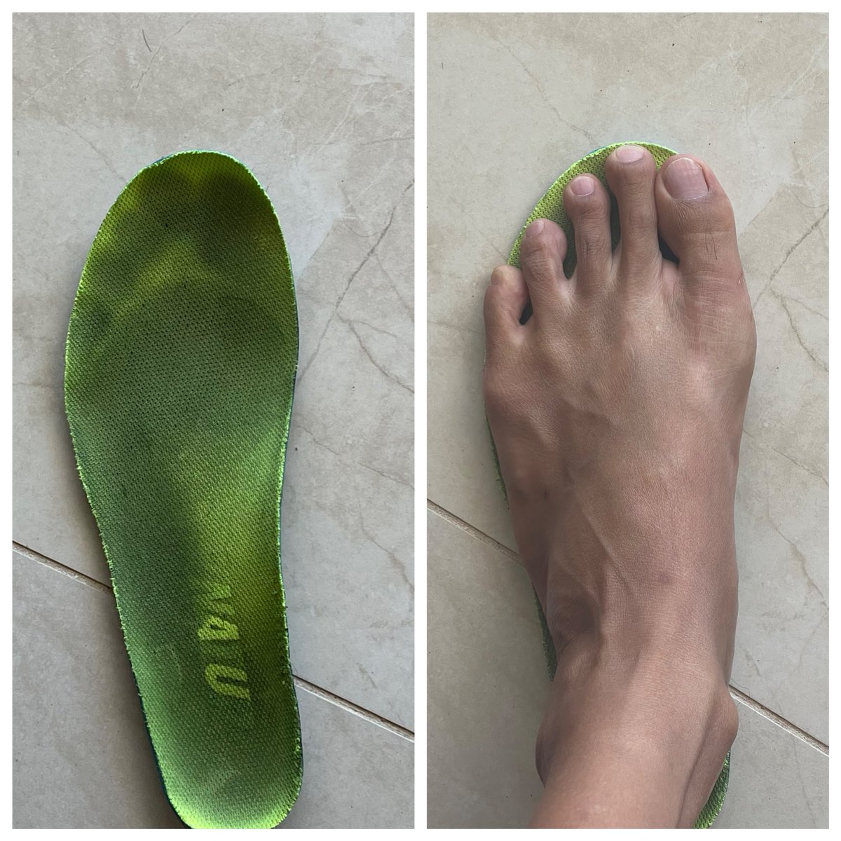 Why your workout shoes are killing your feet (and what to wear instead ...