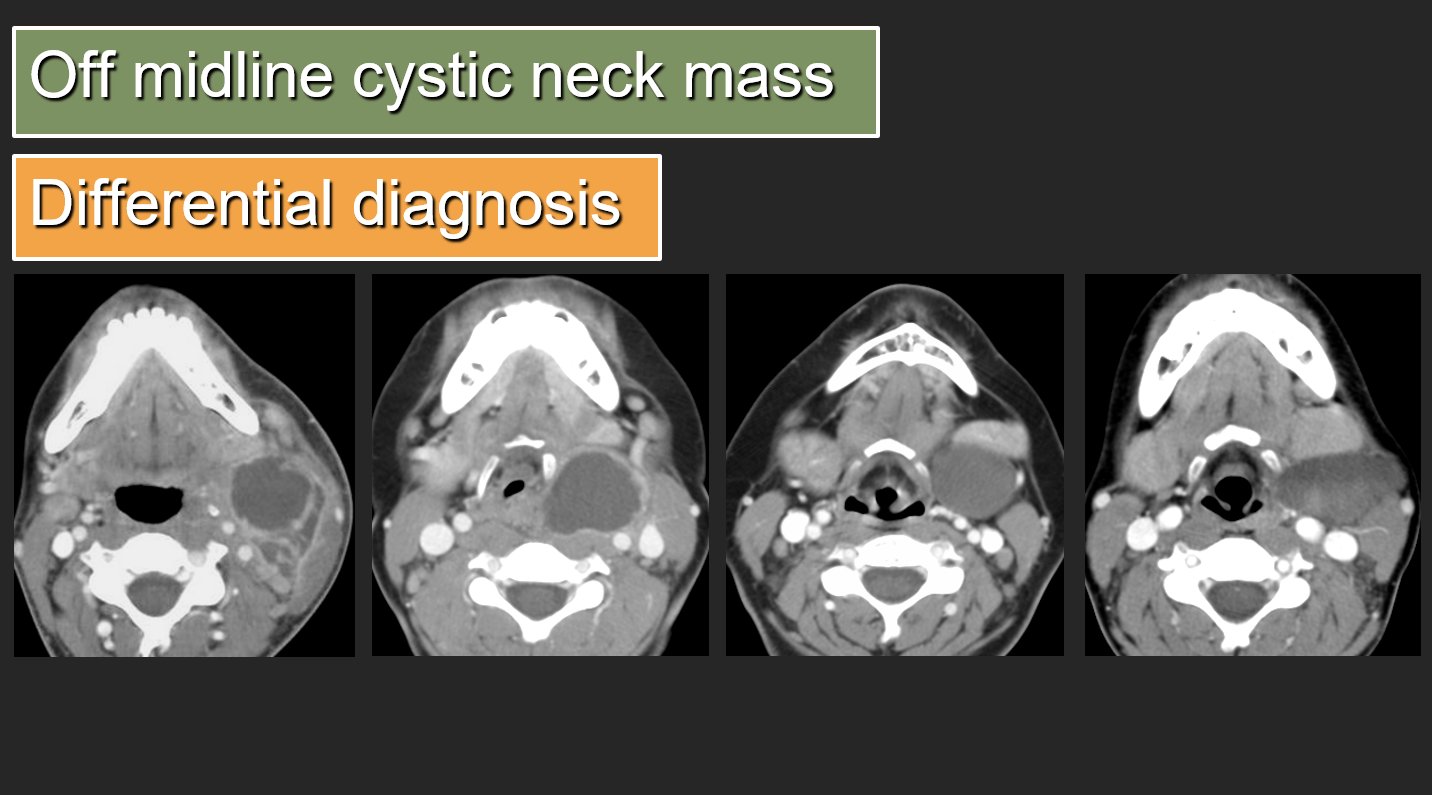 Neck Mass Differential