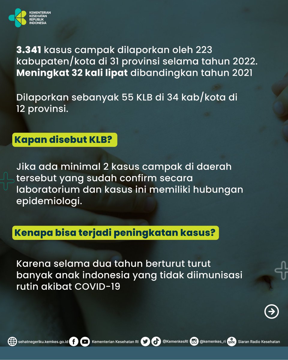 Kementerian Kesehatan RI on Twitter: "Meski tergolong penyakit menular, campak dapat dicegah ...
