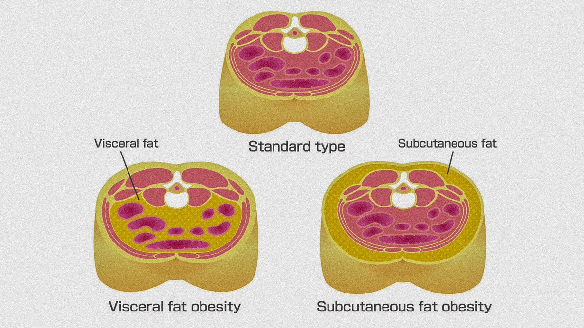 12 reasons you need to lose visceral fat as soon as possible (Why it’s ...