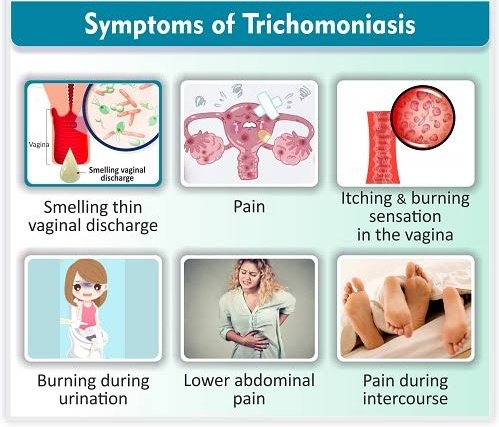 Trichomonas Discharge