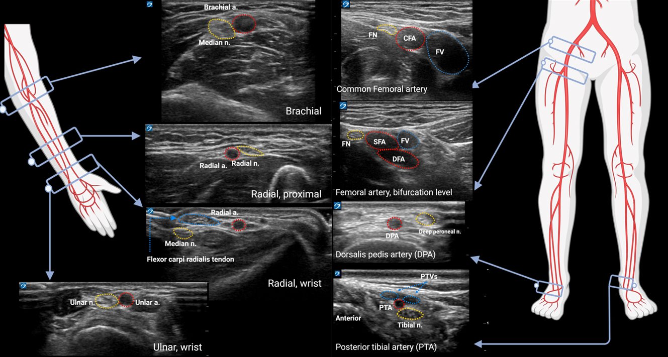 On Radiology Arteries Of Upper Limb
