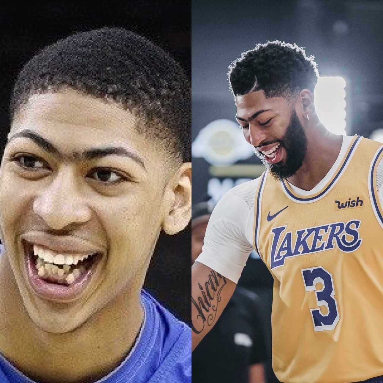 Nba Memes Anthony Davis