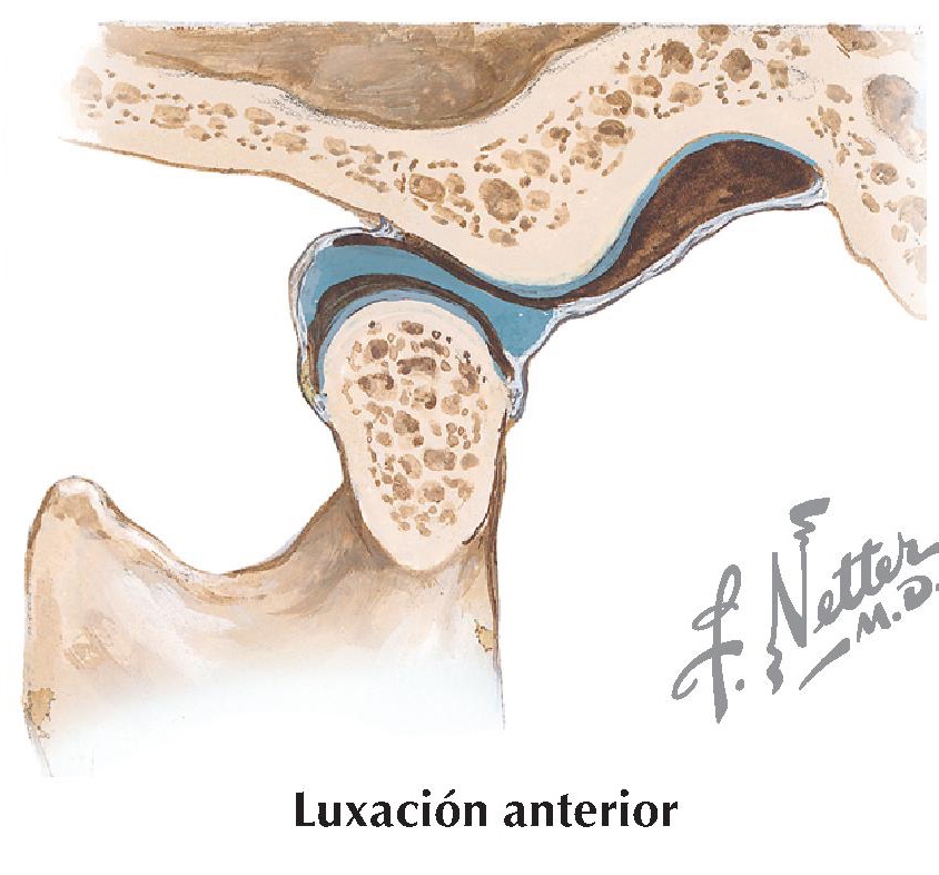 Articulacion Temporomandibular Netter