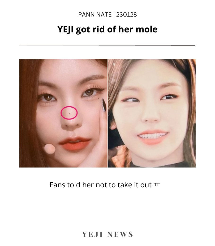 Face Mole Memes YEJI NEWS On X: "[ PANN ] Adding To Theqoo, Instiz,