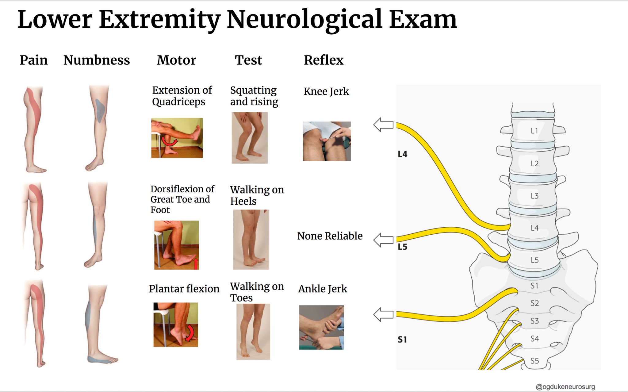 Ankle Dorsiflexion Nerve Root