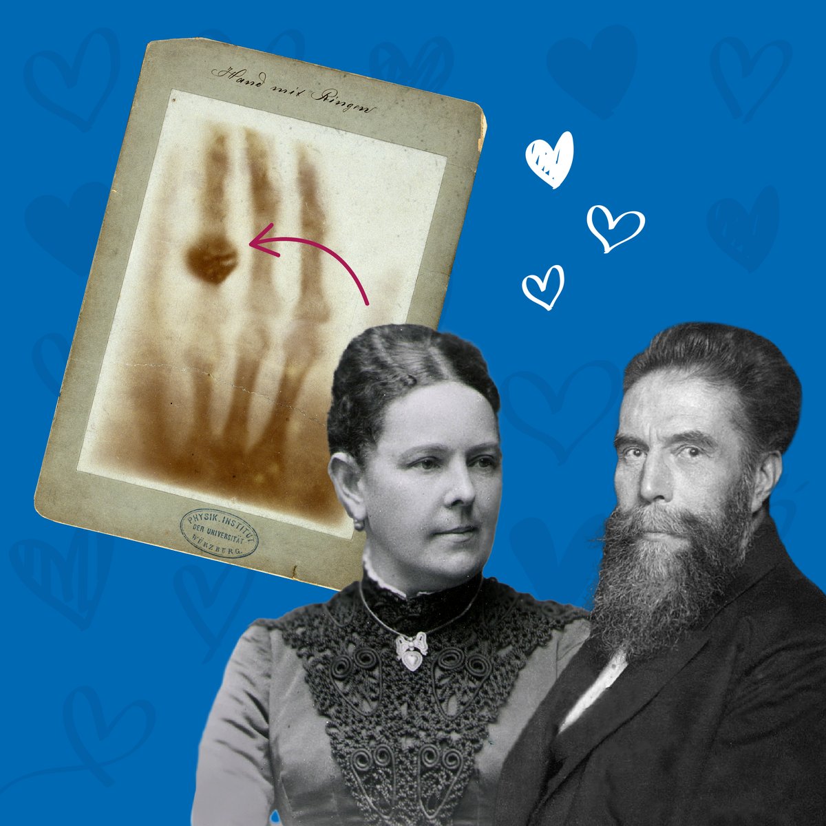 This is the world’s first medical X-ray; and the hand and wedding ring ...