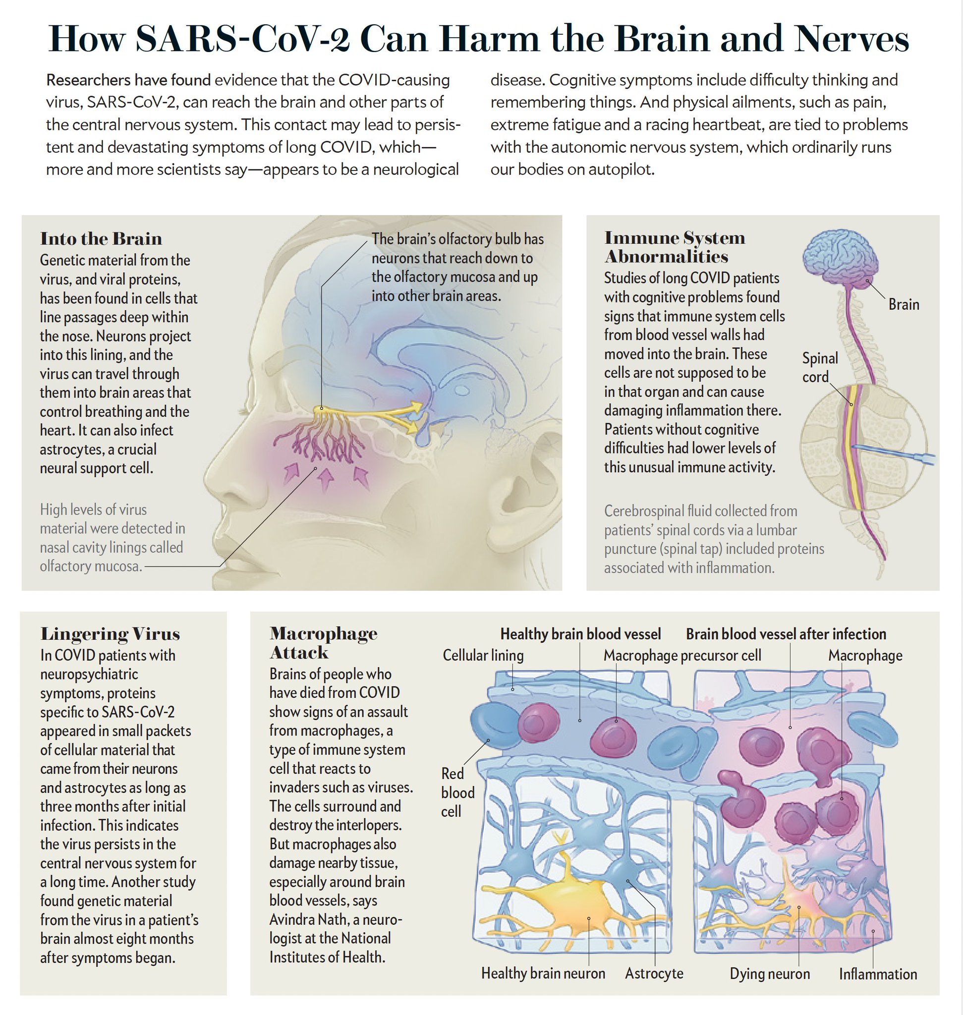 Eric Topol on Twitter: "Neurologic sequelae of #LongCovid https://t.co/aceRT1teZd @sciam by ...