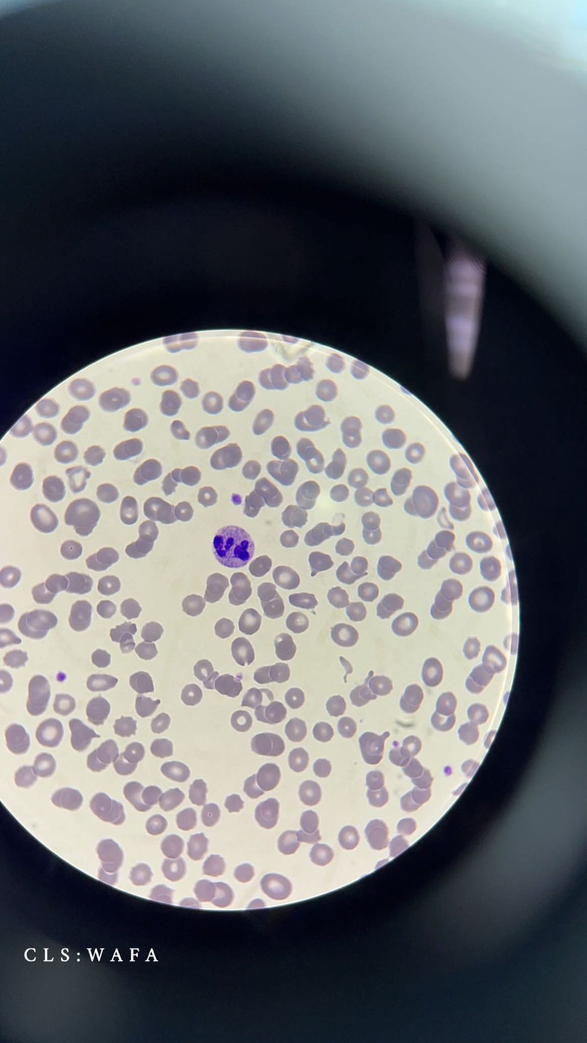 Cytoplasmic Granulation Toxic