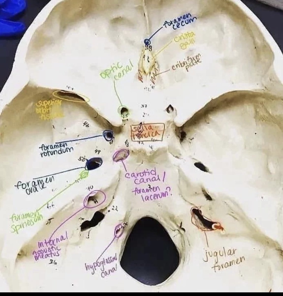 Oren Gottfried MD On Twitter Names Of Little Holes In Skull Which One Is Your Bestie oren-gottfried-md-on-twitter-names-of-little-holes-in-skull-which-one-is-your-bestie