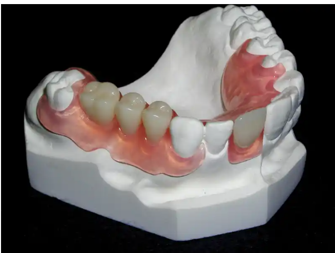 Replace your missing teeth. By replacing missing teeth you restore ...