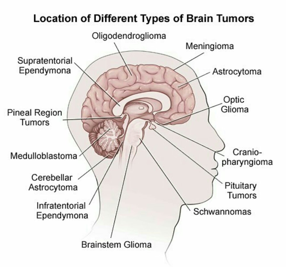 The Innovation Medicine On Twitter Rt Innov Medicine Location Of