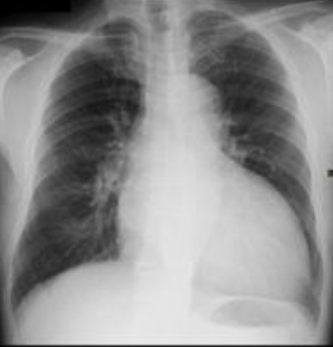 Thread by @Sthanu5 on Thread Reader App – Thread Reader App