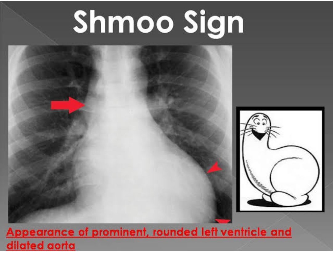 Thread by @Sthanu5 on Thread Reader App – Thread Reader App