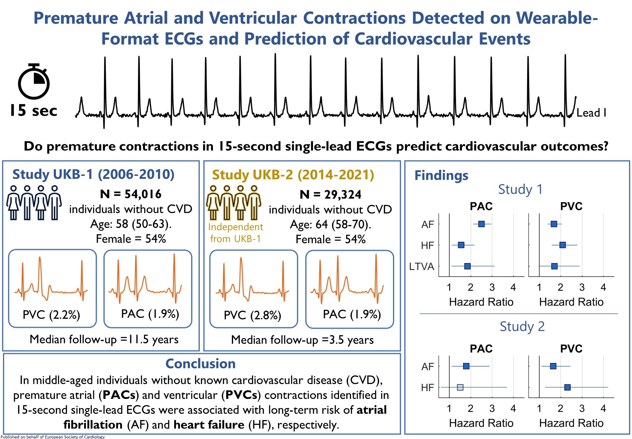 Premature Atrial Contractions Vs Premature Ventricular Contractions