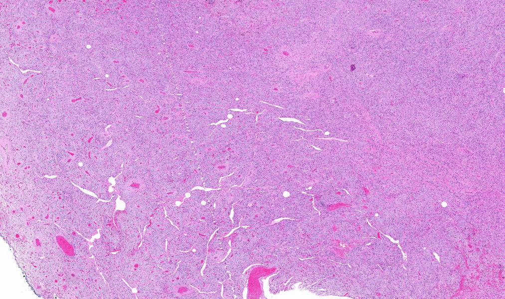 Jerad Gardner, MD on Twitter: Jerad Gardner, MD on Twitter: