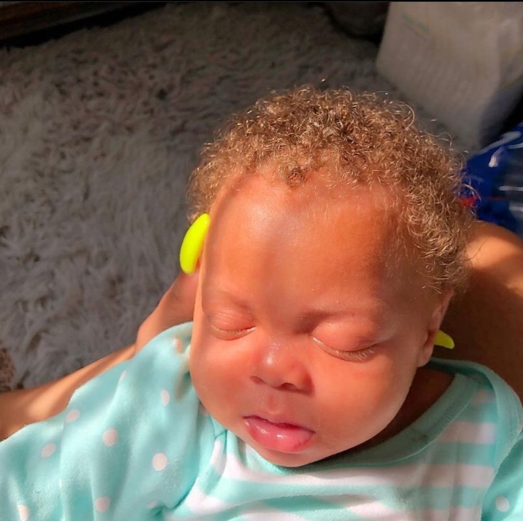 African American Gingers