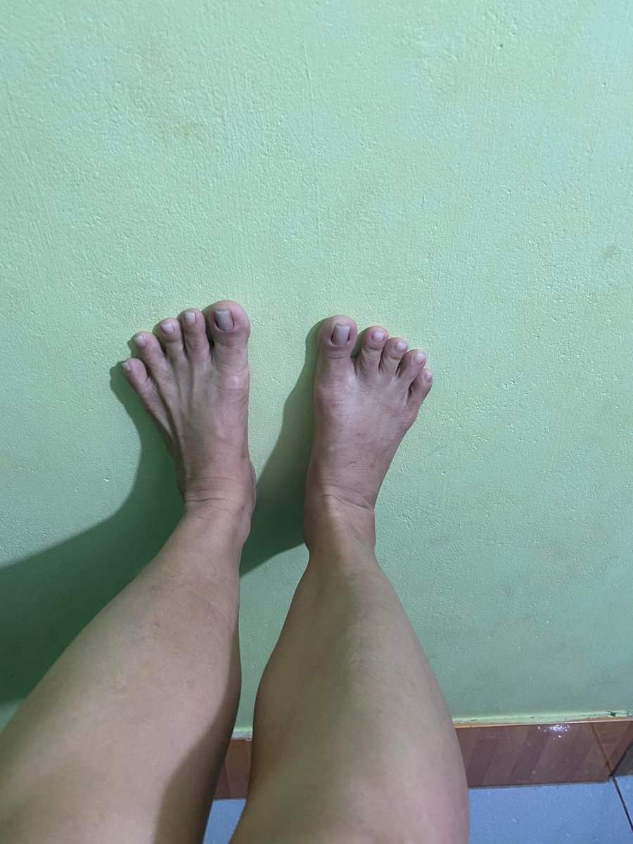 Asias foot hunter on Twitter: "Imagine these on your chest 🙈"