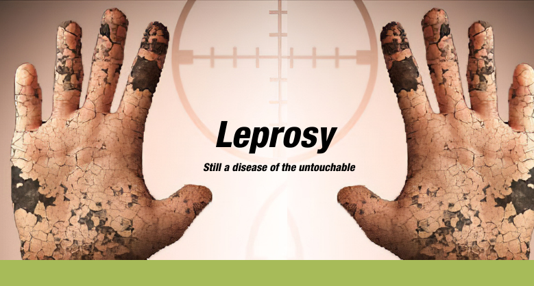 Leprosy Bacteria