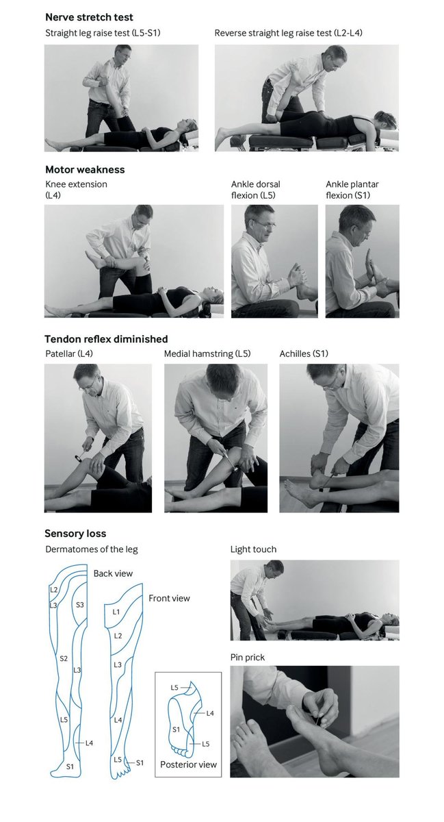 Physio Meets Science on Twitter: "Diagnosis of sciatica 📌 https://pubmed.ncbi.nlm.nih.gov/31744805/"