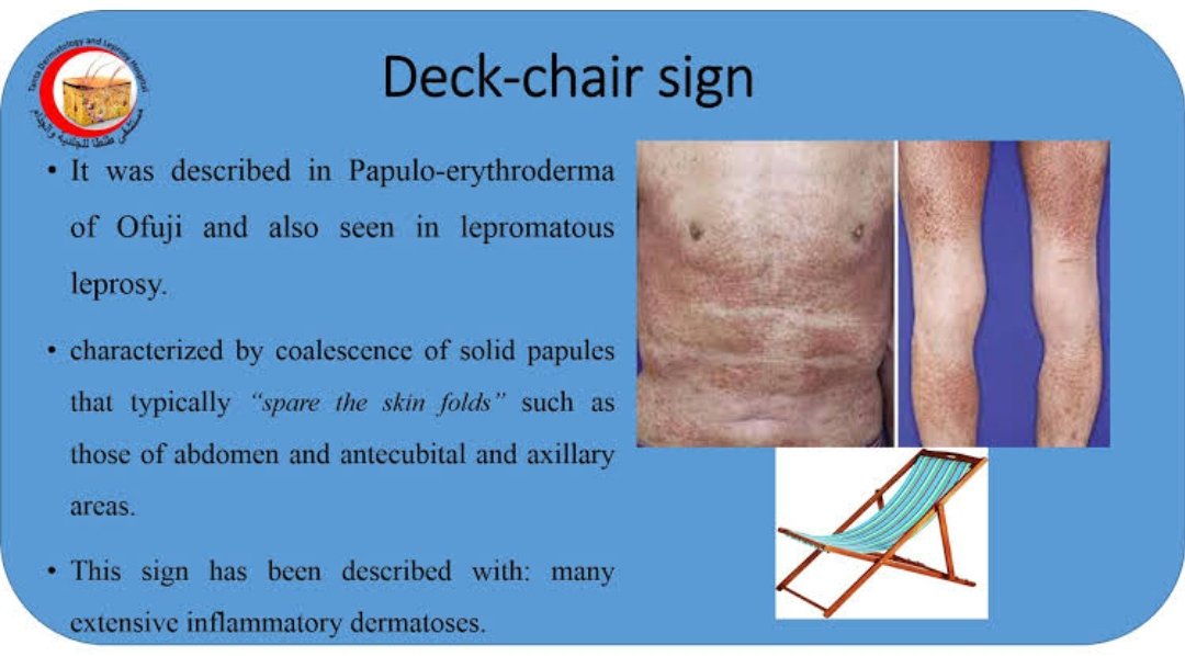 Ofuji Papuloerythroderma