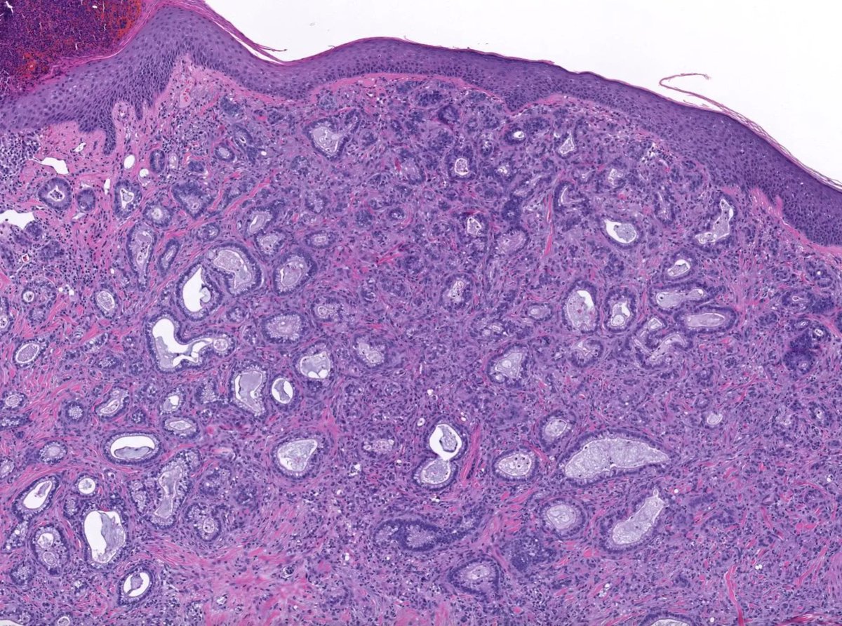 Jerad Gardner Md On Twitter Rt Kiko4docs Middle Aged Man Neck