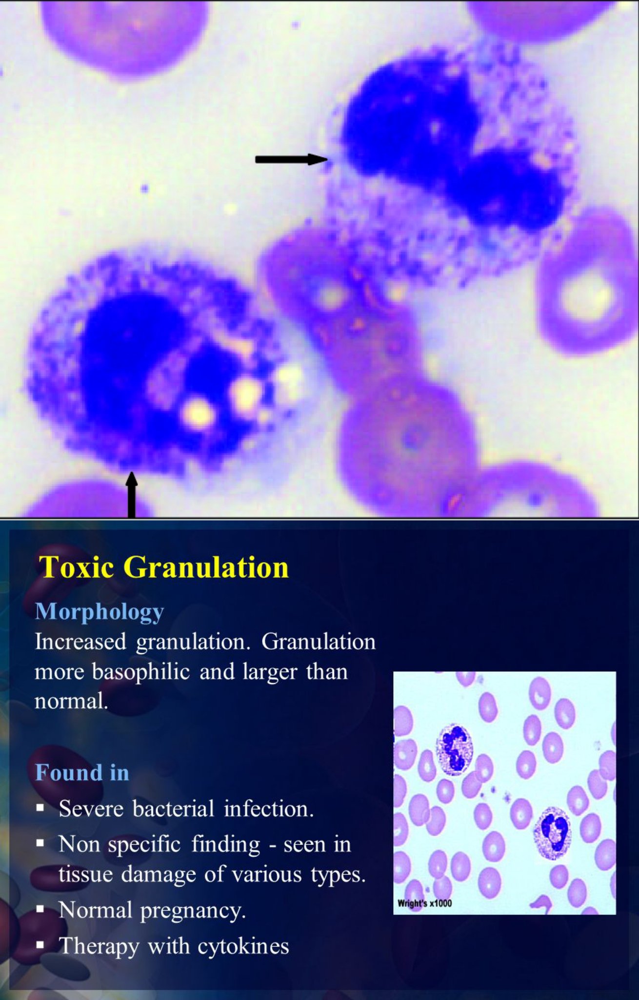 Toxic Granulation