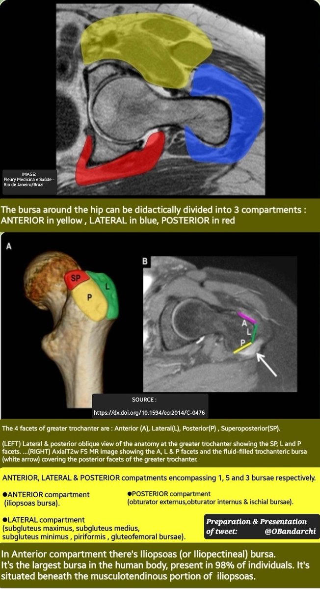 Greater Trochanteric Bursitis Sports Medicine Patient Advisor at Billy ...