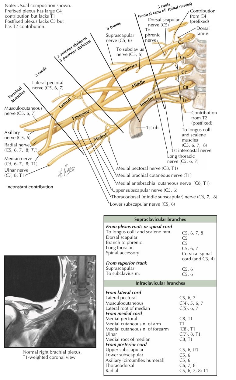 Brachial Plexus Netter