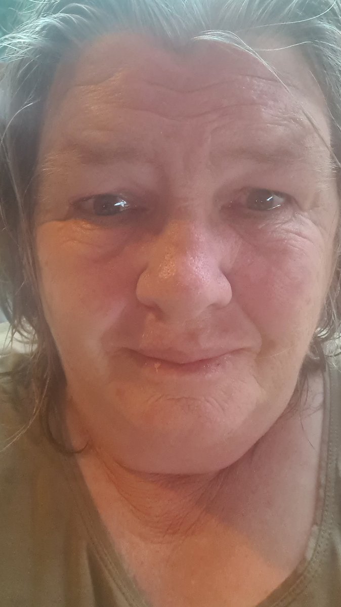 Grow From Here Kaye On Twitter This Twit Decided To Try The New Bath Bubble Without Allergy grow-from-here-kaye-on-twitter-this-twit-decided-to-try-the-new-bath-bubble-without-allergy