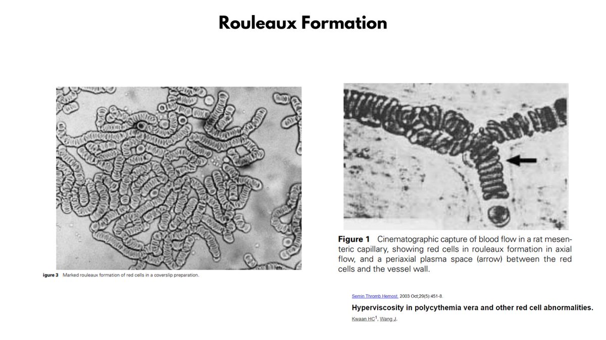 1/8 PERIPHERAL SMEAR QUESTION: Check out the peripheral smear (low ...