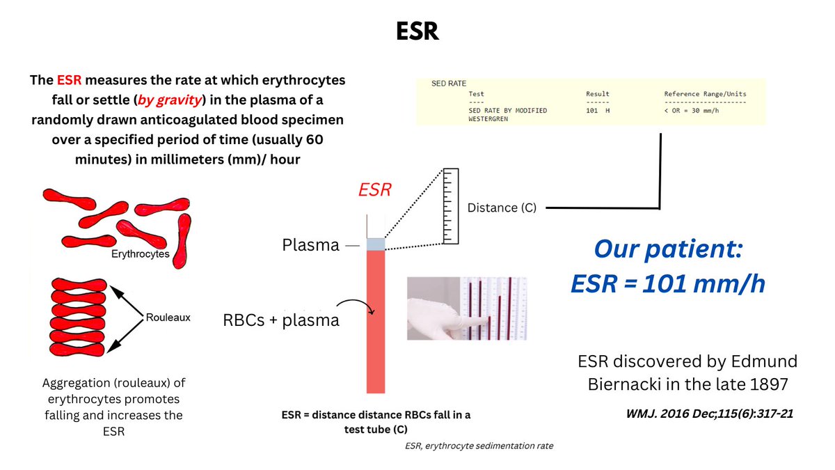 1/8 PERIPHERAL SMEAR QUESTION: Check out the peripheral smear (low power) in the graphic. How ...