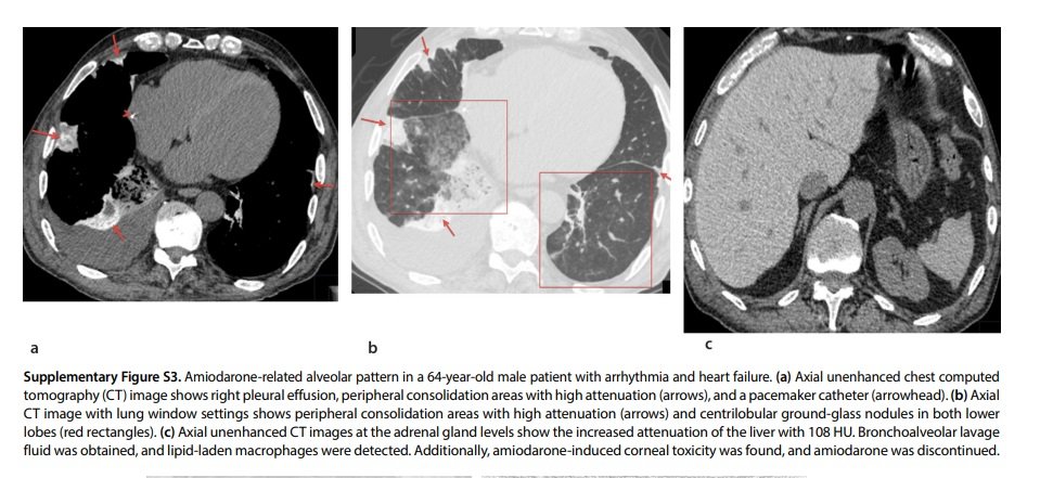 I am pleased to announce that our newest review article (Drug-induced ...