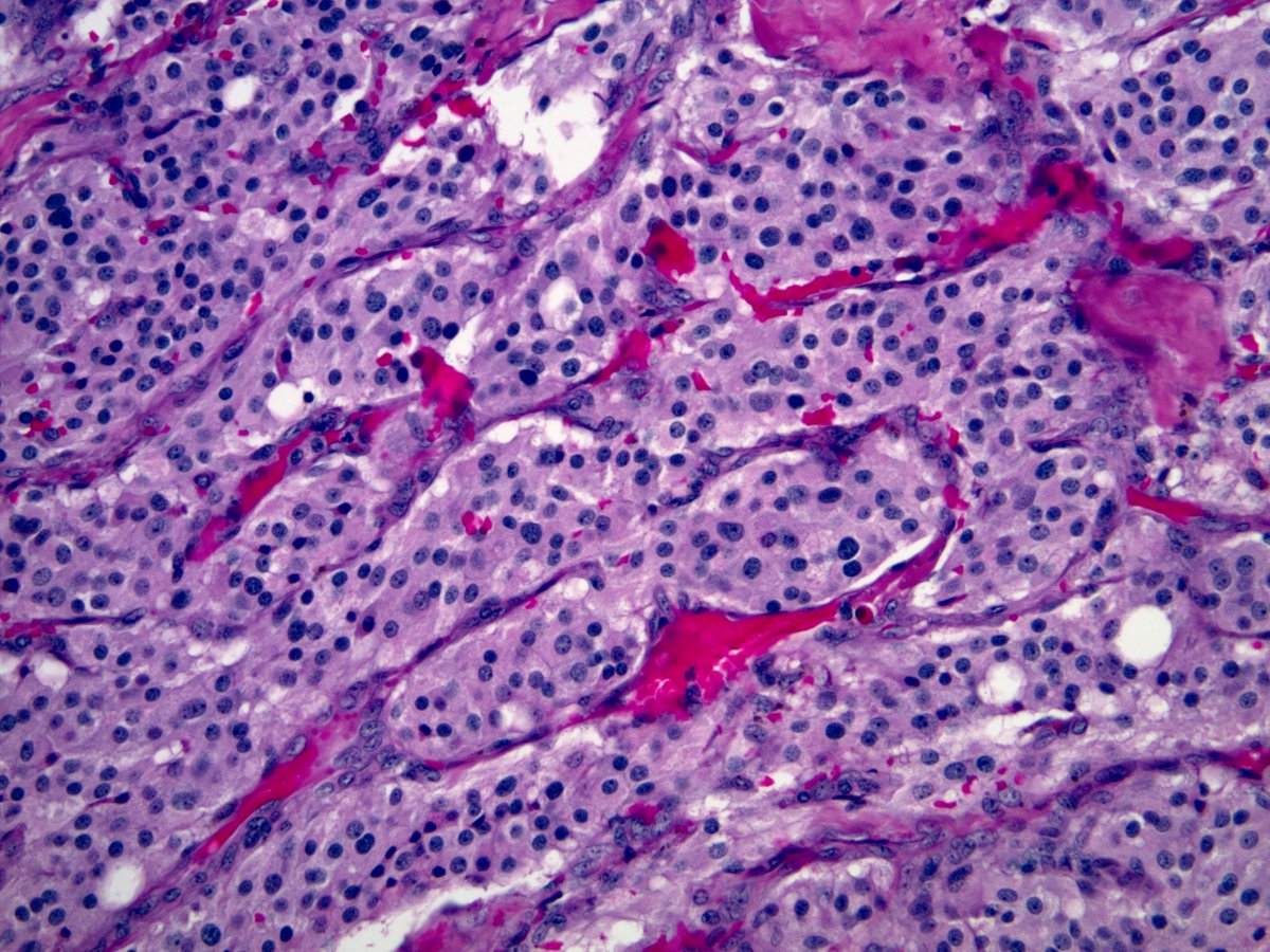 Jerad Gardner, MD on Twitter: Jerad Gardner, MD on Twitter: