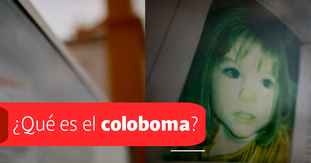 Conozca qué es el coloboma, la afección que identificaba a Madeleine ...