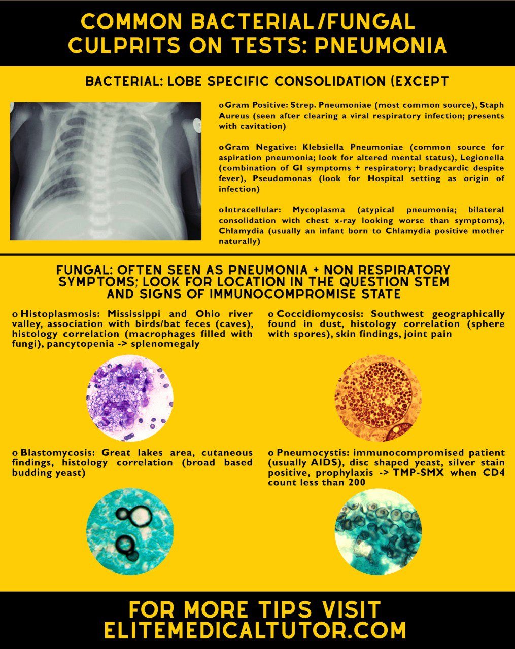 Elite Medical Tutor on Twitter: "[TEST-TAKING TIPS] Common Bacterial ...
