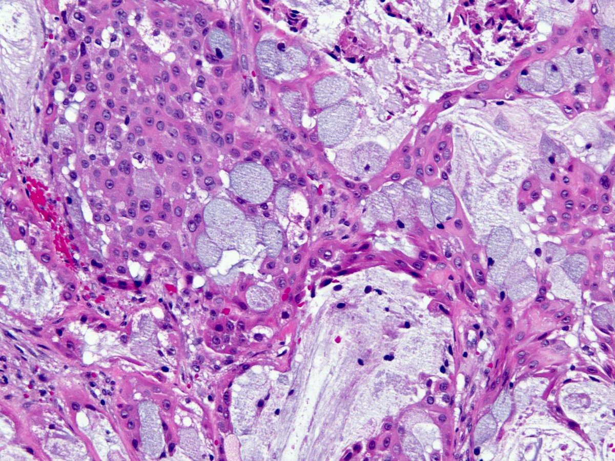 Jerad Gardner, MD on Twitter: Jerad Gardner, MD on Twitter: