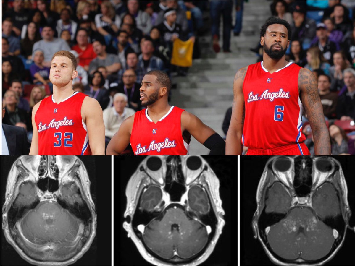 What do these pictures have in common? 1. The 2010 Clippers 2. The ...