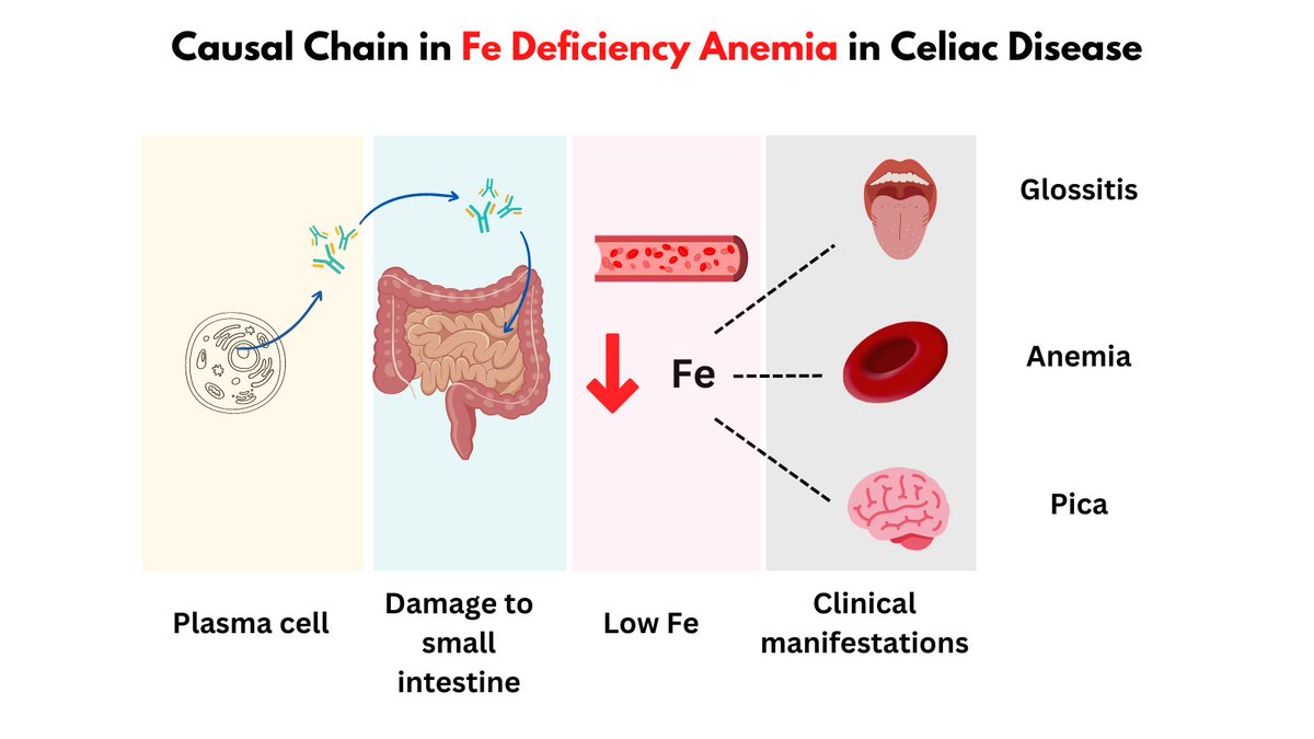 1/4 WHAT'S IN A NAME? Pernicious anemia (PA) is an umbrella term used ...