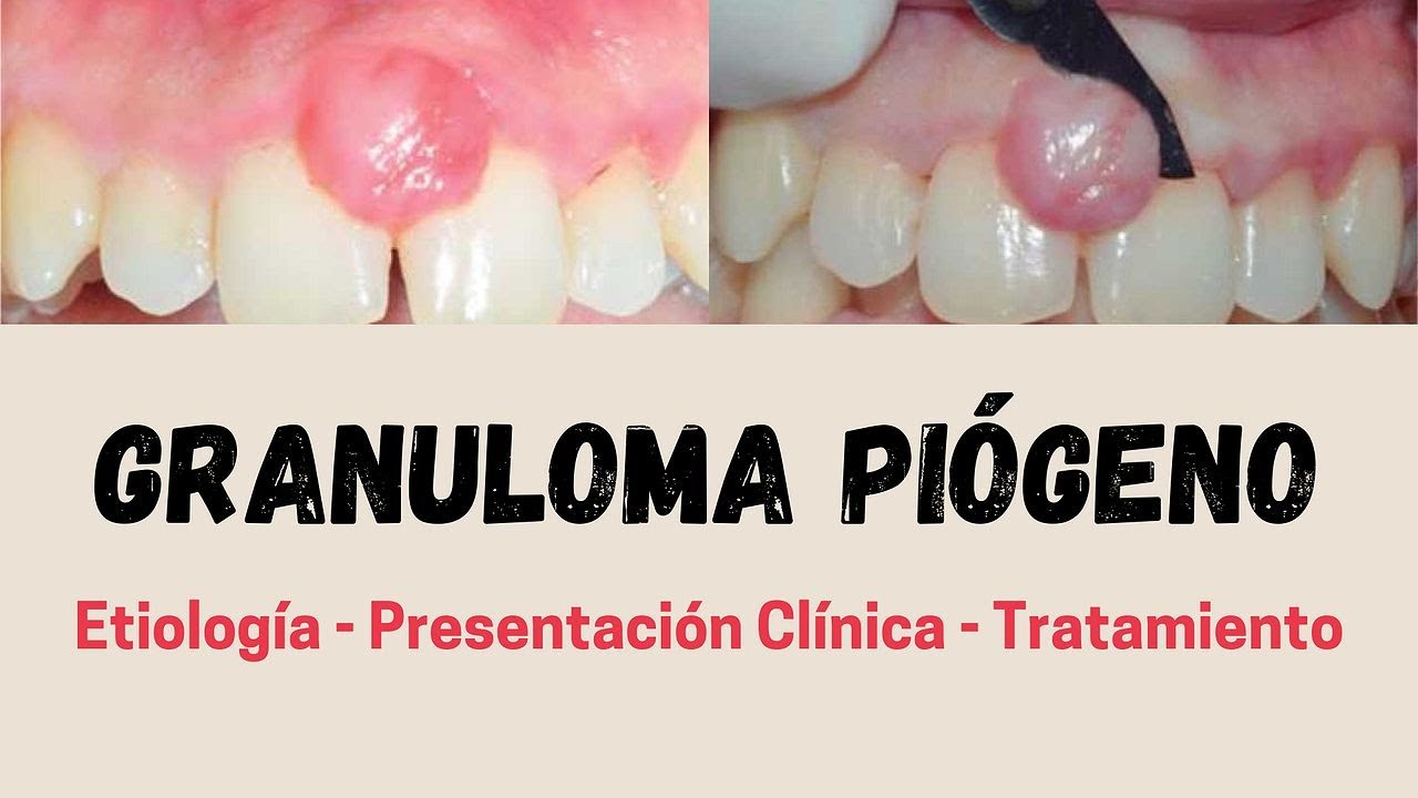 OVI Dental (@OviDentalGo) / Twitter