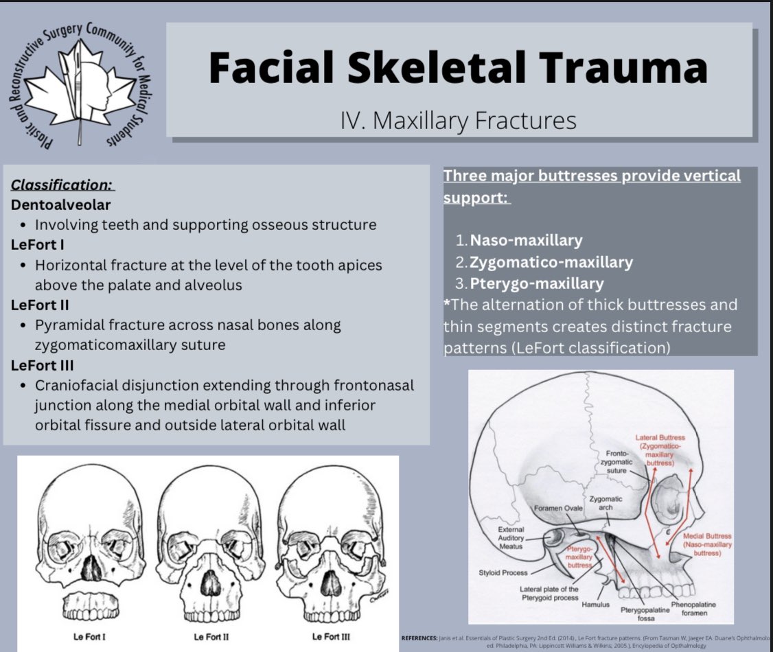 Frontonasal Junction