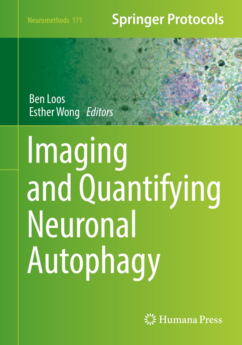 The NeuroNetwork on Twitter: "Quantifying microscopic images can be tricky! The book Imaging and ...