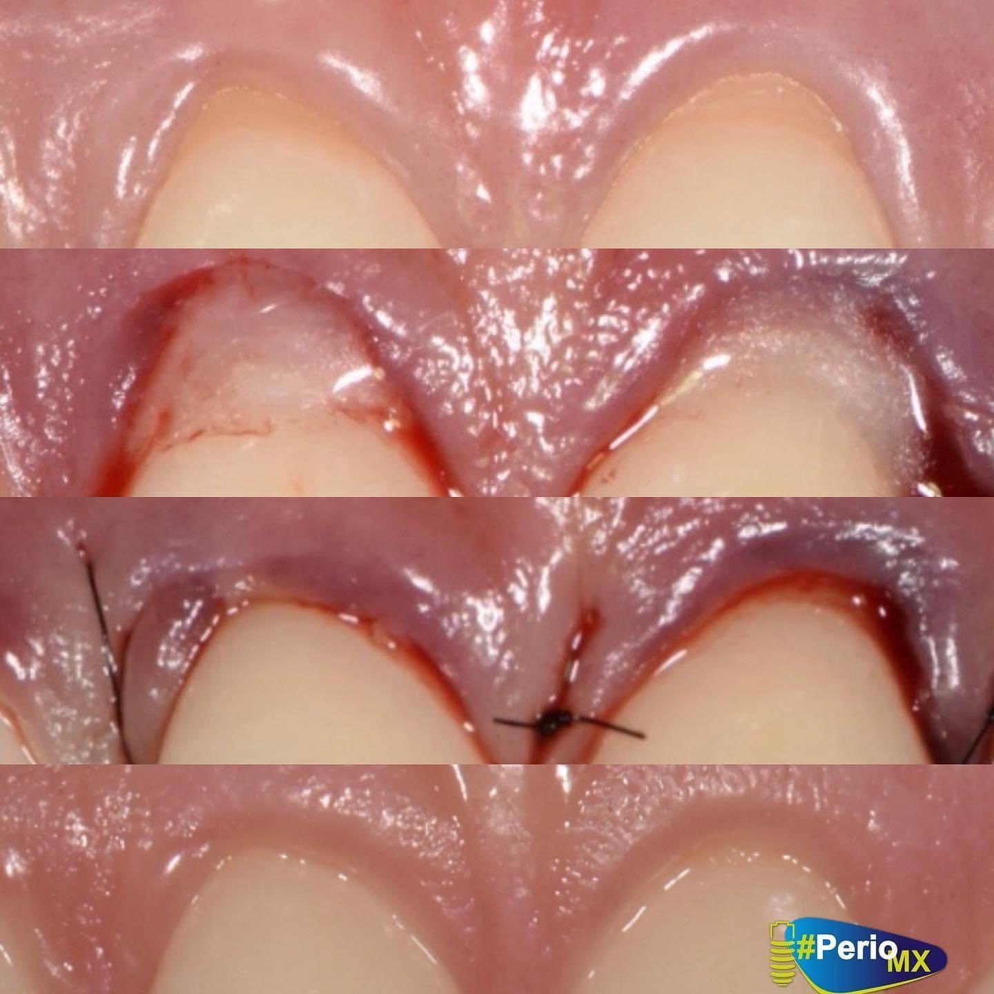 OVI Dental (@OviDentalGo) / Twitter